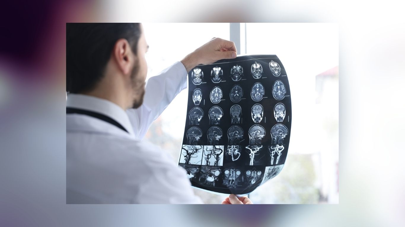 CTE Tied To 4.5x Dementia Risk