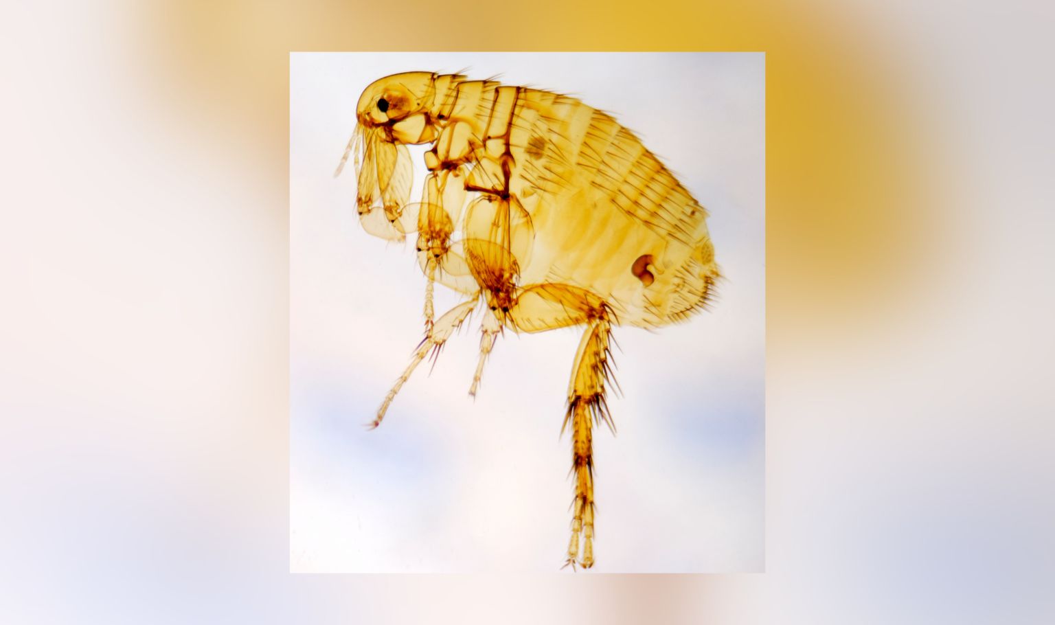 Typhus Cases On The Rise In California And Texas